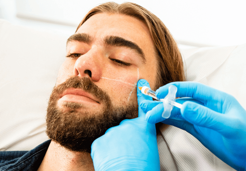 Everything You Need to Know About Cheek Fillers | REVOLAX UK